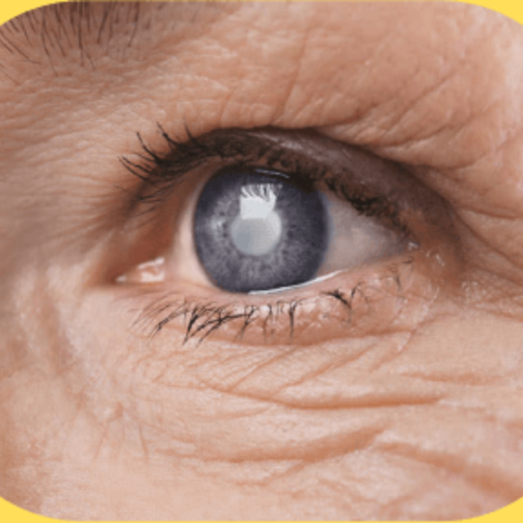 Clear Sight | Eye Food Supplement Lutein